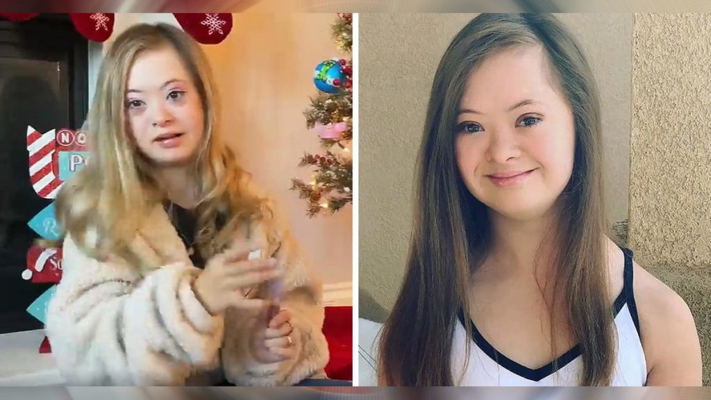 Defying All Odds: Young Woman With Down Syndrome Becomes Model and ...