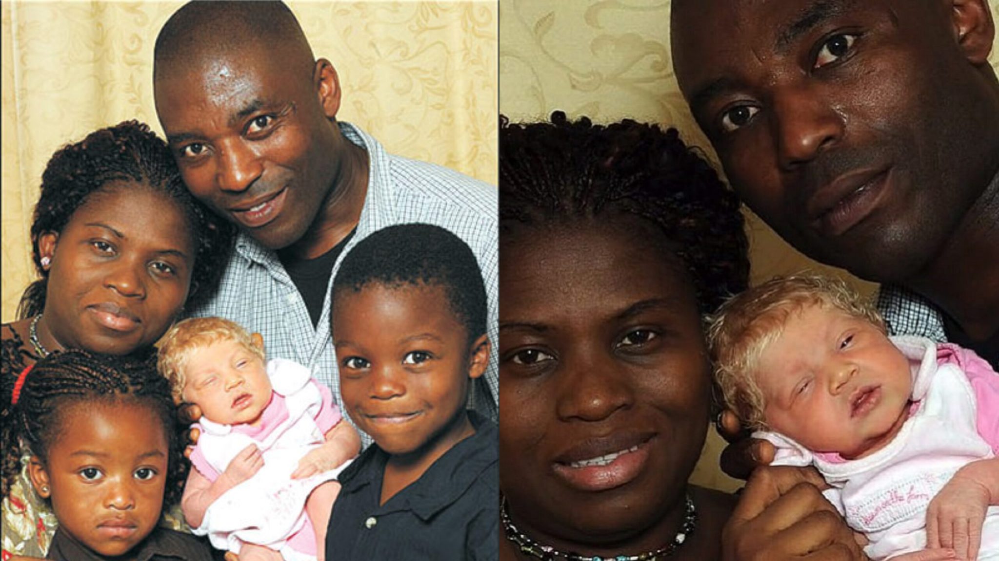 10 Years Ago, Snow White Baby Was Born In A Black Family, What Does The ...