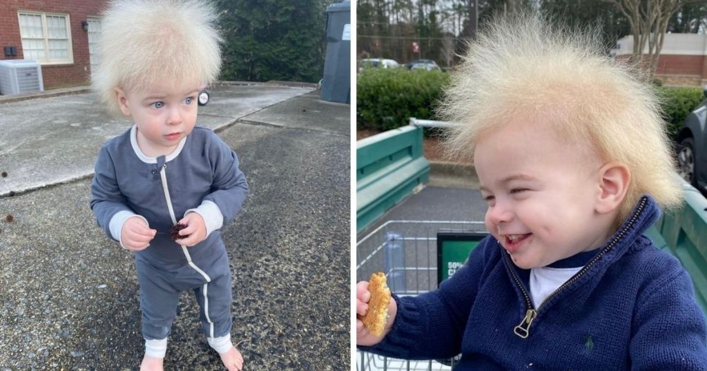 Toddler With Super-rare ‘Uncombable Hair Syndrome’ Spreads Joy On ...
